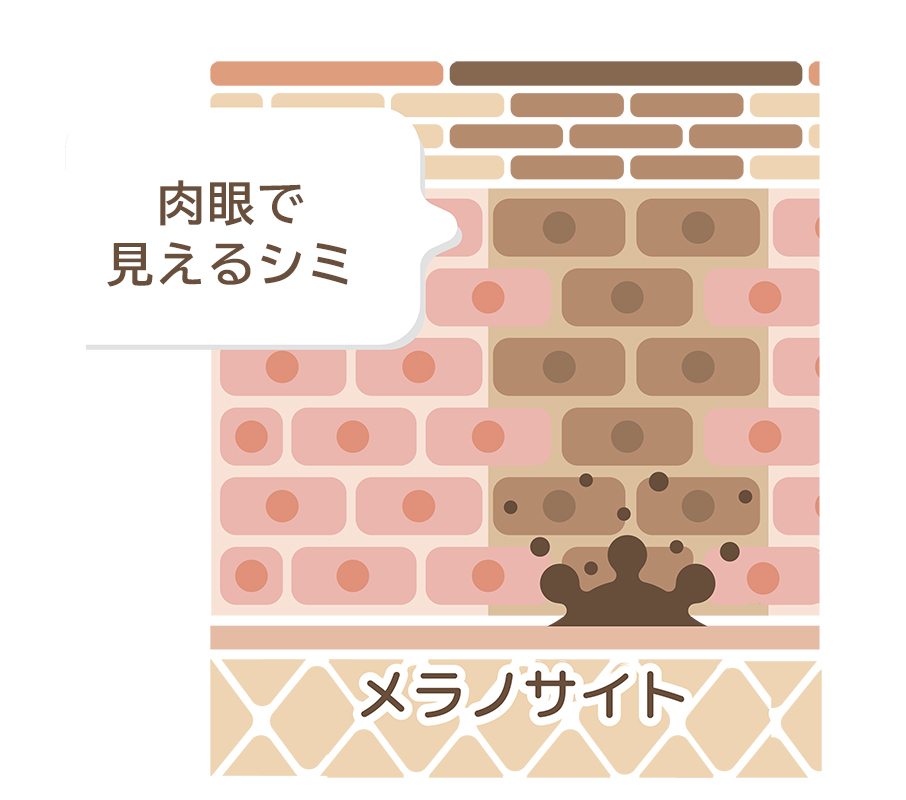 私がシミ治療前に必ず画像診断をする理由｜あざみ野ヒルズスキンクリニック