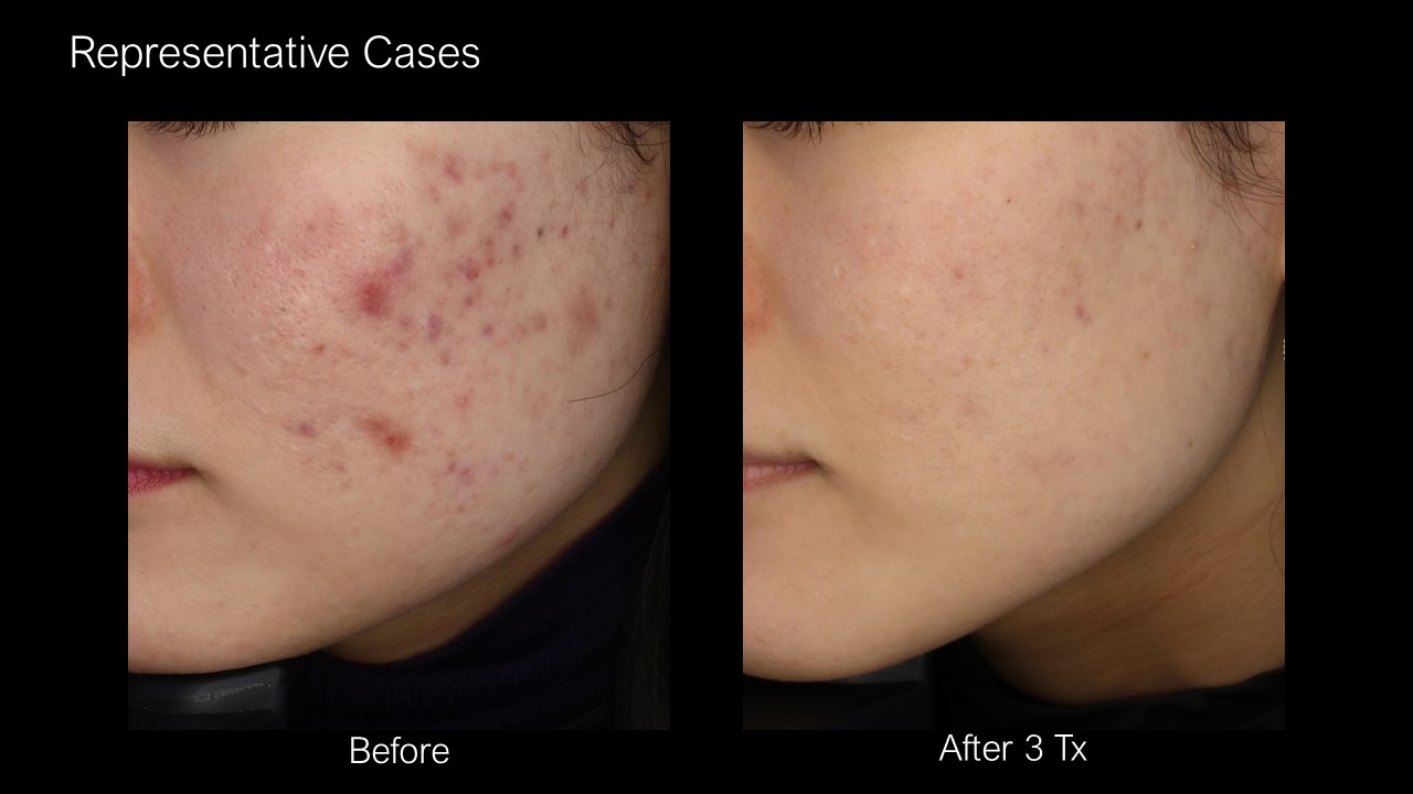 CynoGlowワールドツアーinタイ・バンコク